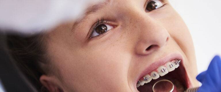 ¿Qué función tiene el cóndilo mandibular? - Clínica de ortodoncia Dra ...