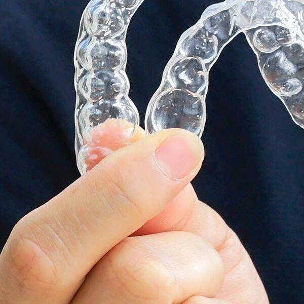 ¿Qué función tiene el cóndilo mandibular? - Clínica de ortodoncia Dra ...